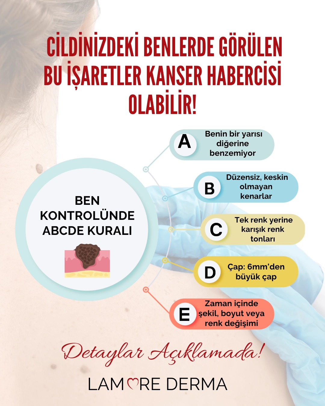 Zeynep Akçay YAYLIM